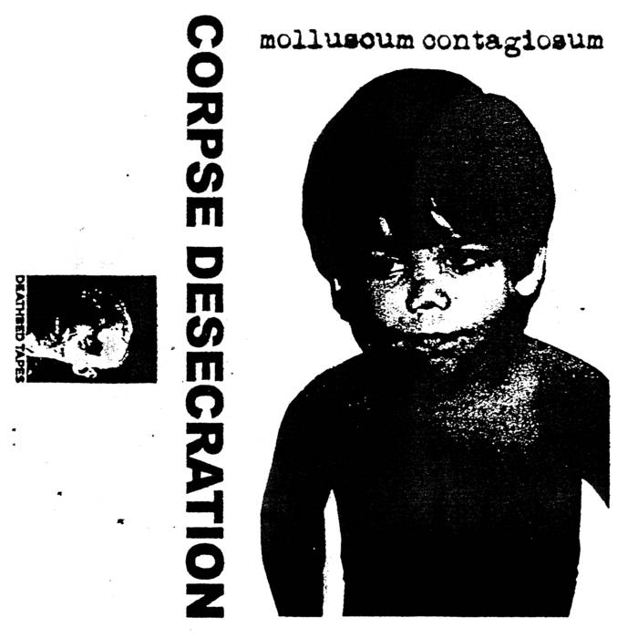 Molluscum Contagiosum | Corpse Desecration | deathbed tapes