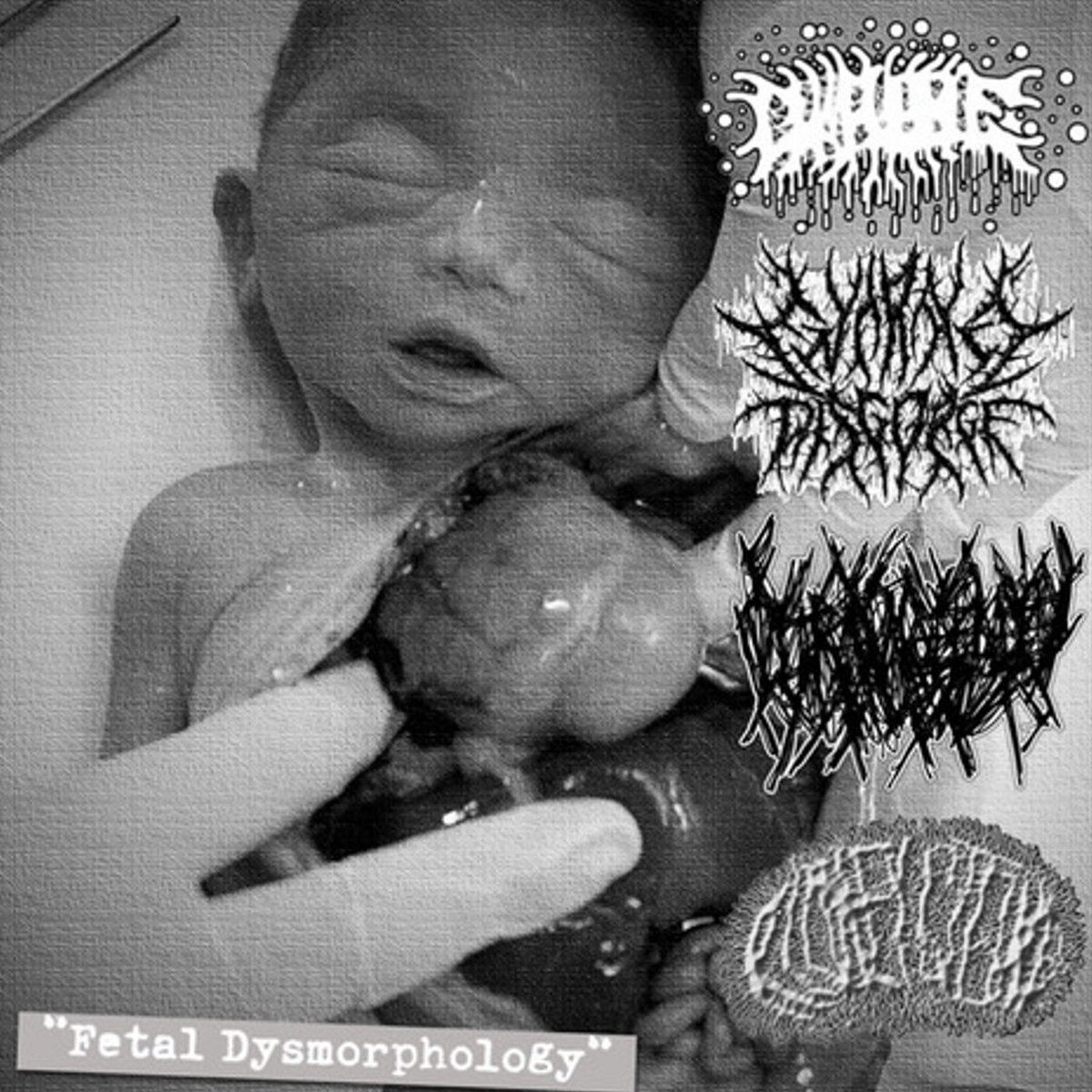 Fetal Dysmorphology 4 Way Split | Entrail Disgorge