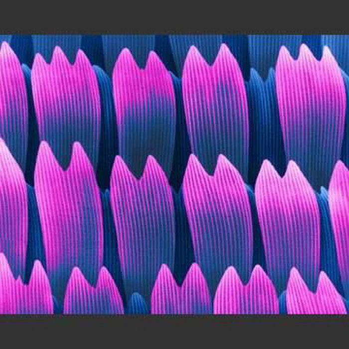 DESUETUDE (Decay Of Innocence) | misophonia