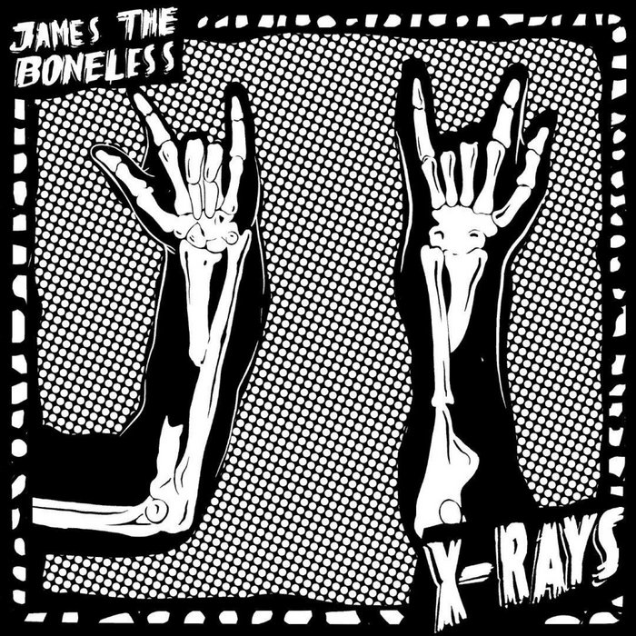 Glass Joe (X-Rays Version) | James The Boneless