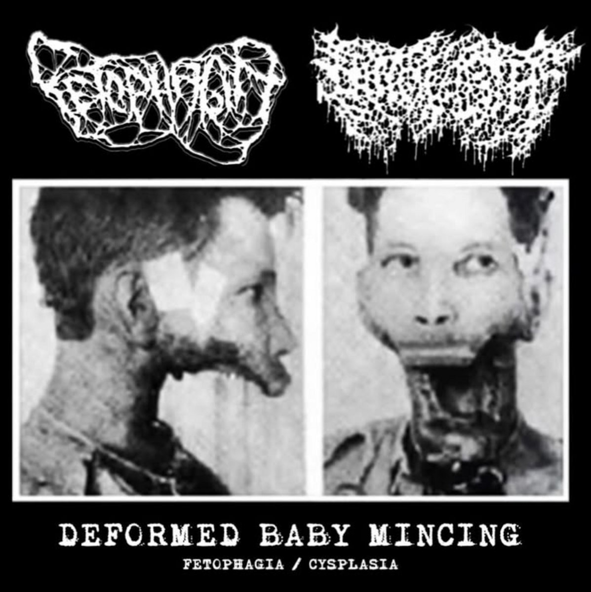 Deformed Baby Mincing | Cysplasia / Fetophagia | Cysplasia