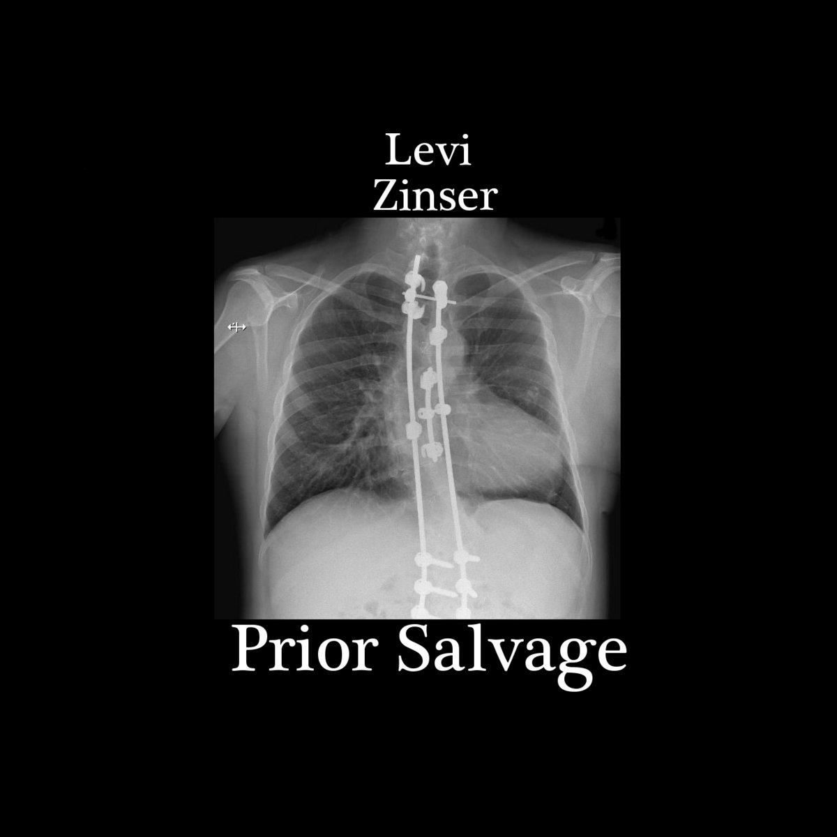 Prior Salvage | Levi Zinser