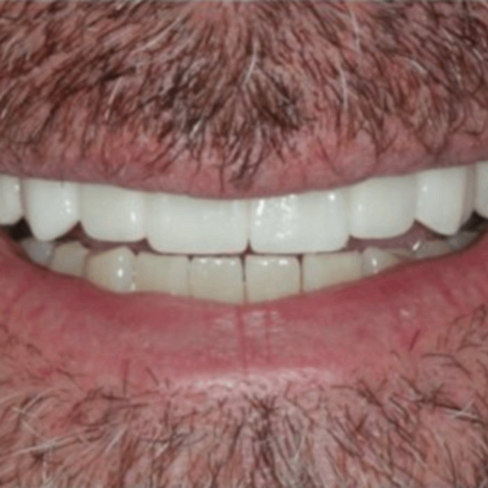 Goblin Diplomacy b/w Gabi's Song | transmitterrr