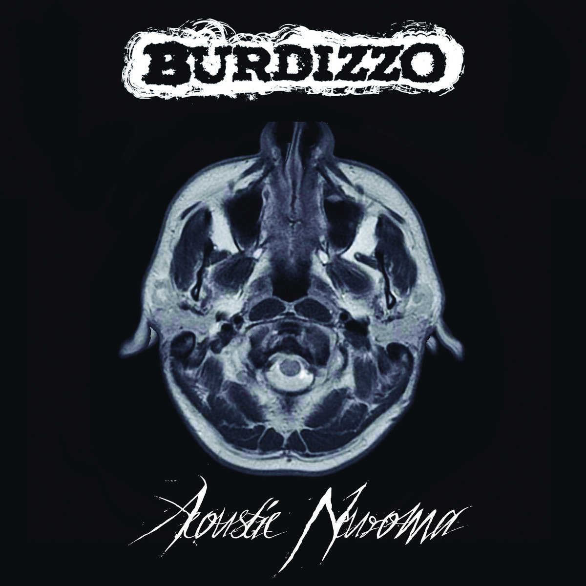 Netflixxx and Kill | Burdizzo
