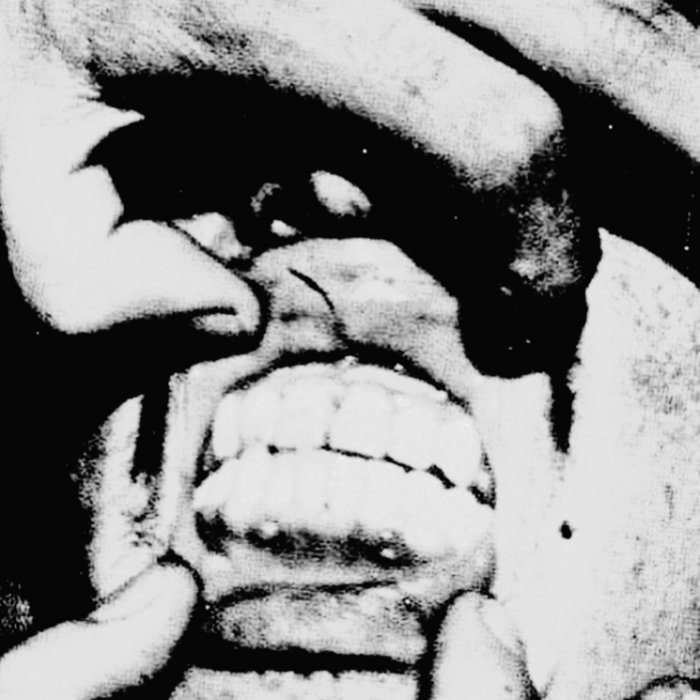 Disfigured Robot Child X Mente-Atada | Disfigured Robot Child X Mente ...