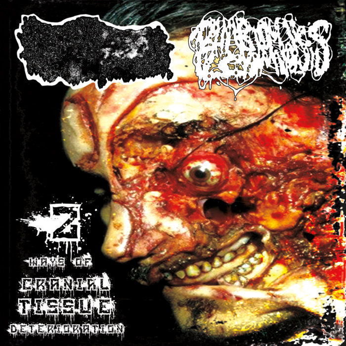 2 Ways of Cranial Tissue Deterioration - Split W/ Rhabdomyolysis ...