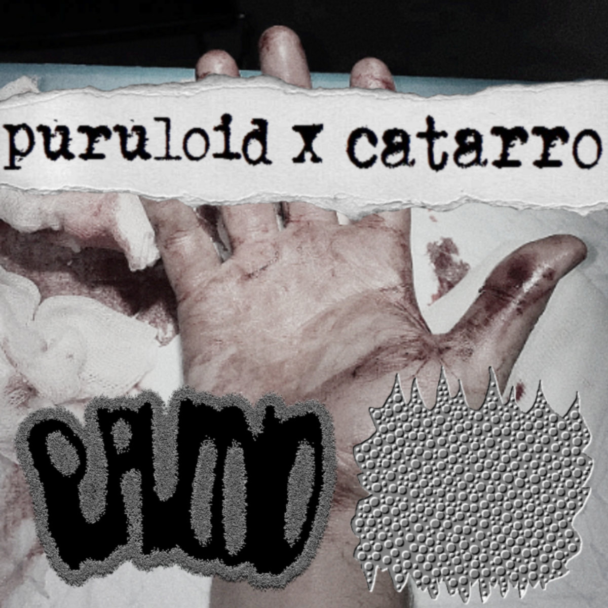Catarro / Puruloid Split | Puruloid, Catarro | Puruloid