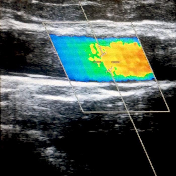 Thrill & Bruit | Patrick Corcoran