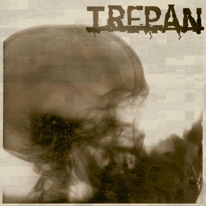 Trepan | Trepan