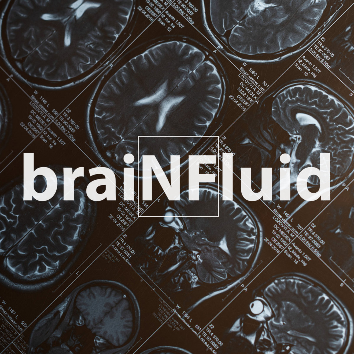 Brain Fluid | Brain Fluid | BrainFluid