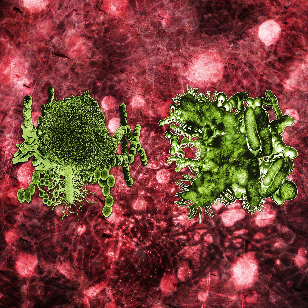 Split w/ Bacteriophagal Reconstruction | Mehicillin-Resitant ...