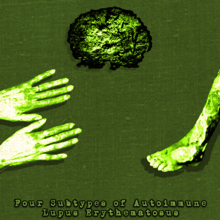 Four Tracks for Four Subtypes of Autoimmune Lupus Erythematosus ...