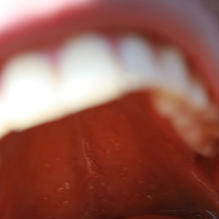 Neue Frakturen | monad node