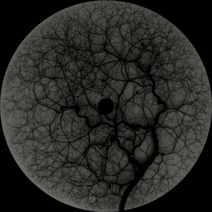 Fourier Methods | AXOON