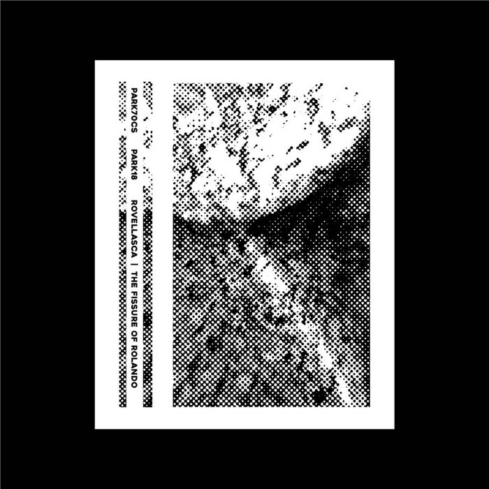 The Fissure of Rolando | Rovellasca