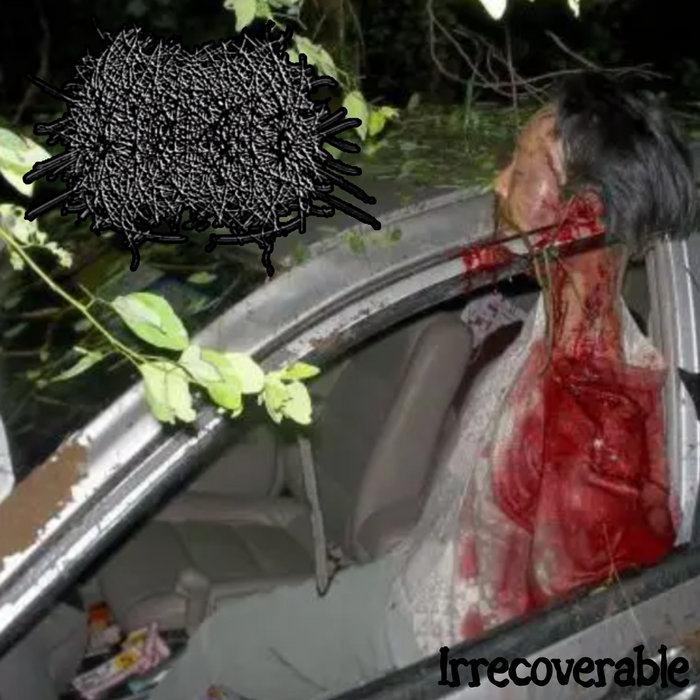 Irrecoverable | Walking Corpse Syndrome | Peripheral Neuropathy Productions