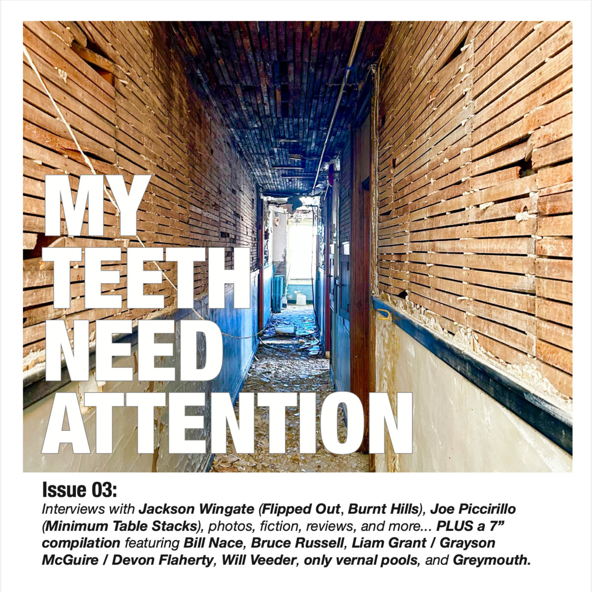 My Teeth Need Attention #3 | Various Artists | Carbon Records