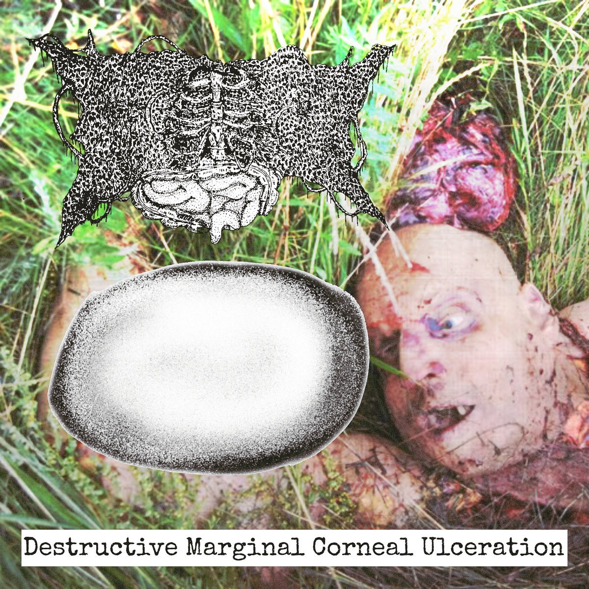 PNEUMONIA / FUNGATING SOFT TISSUE SARCOMA - DESTRUCTIVE MARGINAL ...