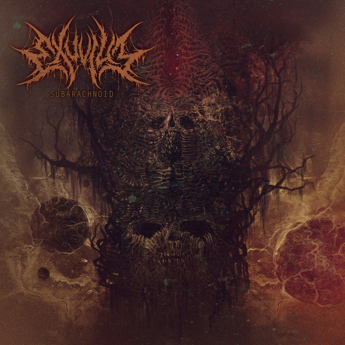 Subarachnoid | Exuvium