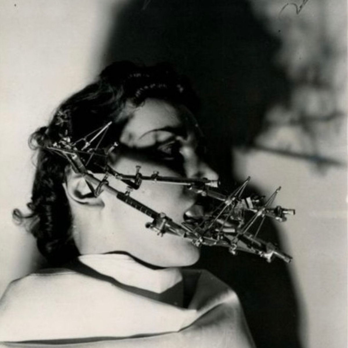 Creepy Vintage Medical Photos