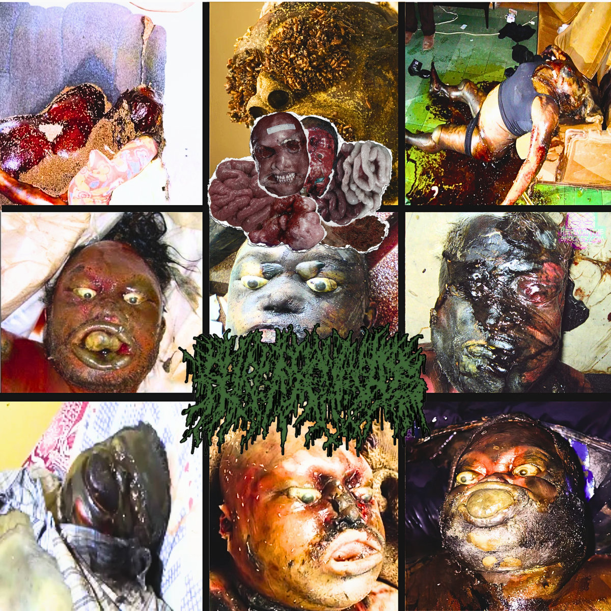 Split w/ Shrunken Heads | Hemorrhagic Necrotizing Enterocolitis ...