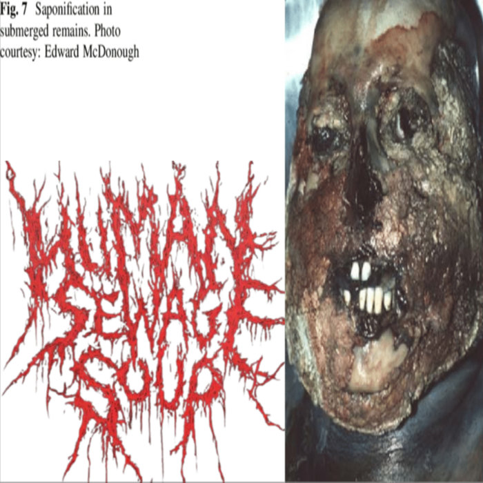 when I awoke, my rotted skin tore off as my head rose from my pillow ...