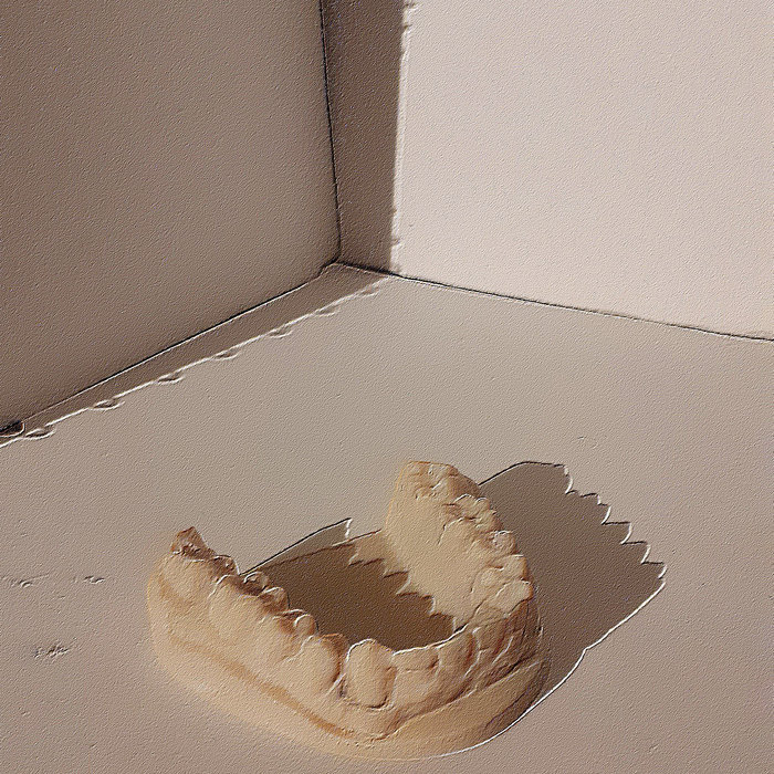 Pulling Teeth | Sam Erickson