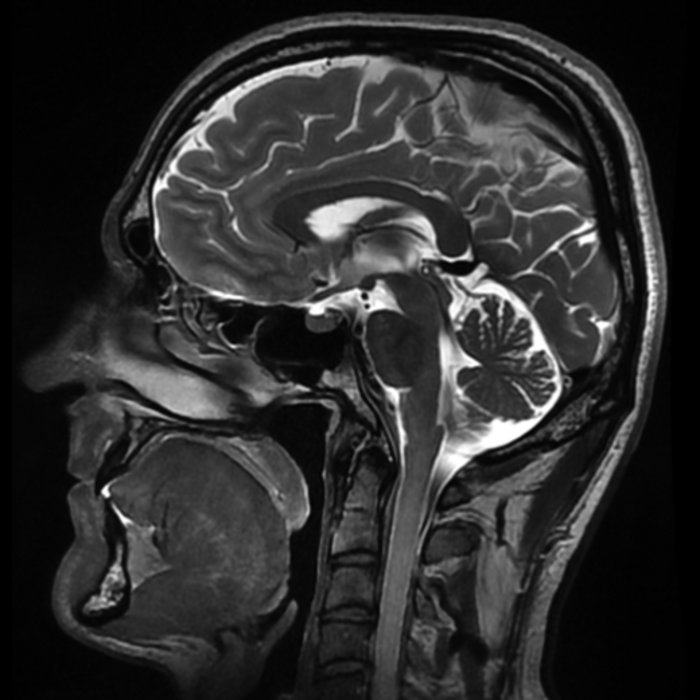 Collapsing Mind | impakt/Jørgen Indal